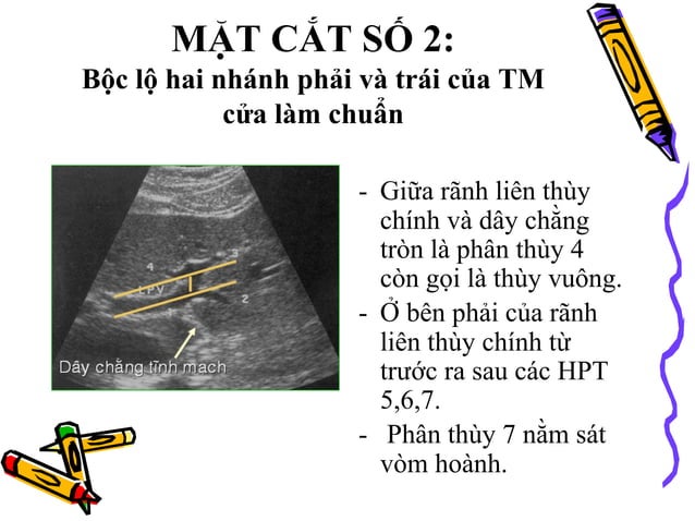 Các mặt cắt cơ bản siêu âm bụng | PDF