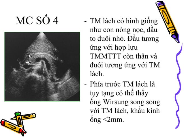 Các mặt cắt cơ bản siêu âm bụng | PDF