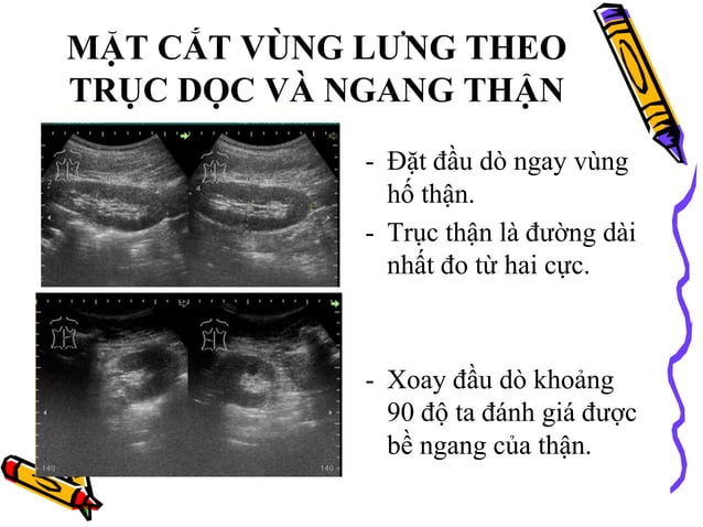 Các mặt cắt cơ bản siêu âm bụng | PDF