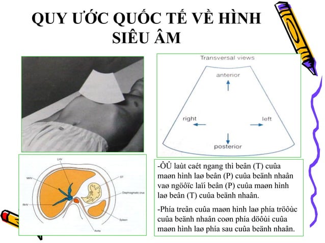 Các mặt cắt cơ bản siêu âm bụng | PDF