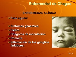 Chagas | PPT