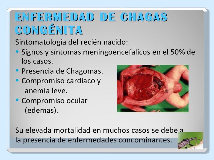 Chagas
