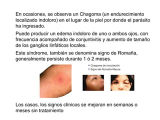 Chagoma