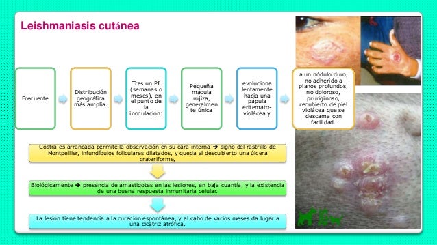 CHAGAS Y LEISHMANIASIS
