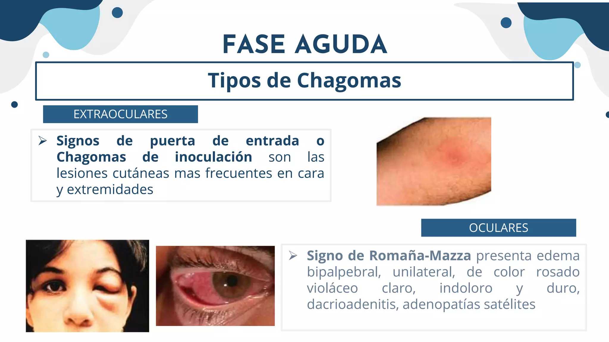 Enfermedad de Chagas (T. cruzi) - Pediatría | PPTX