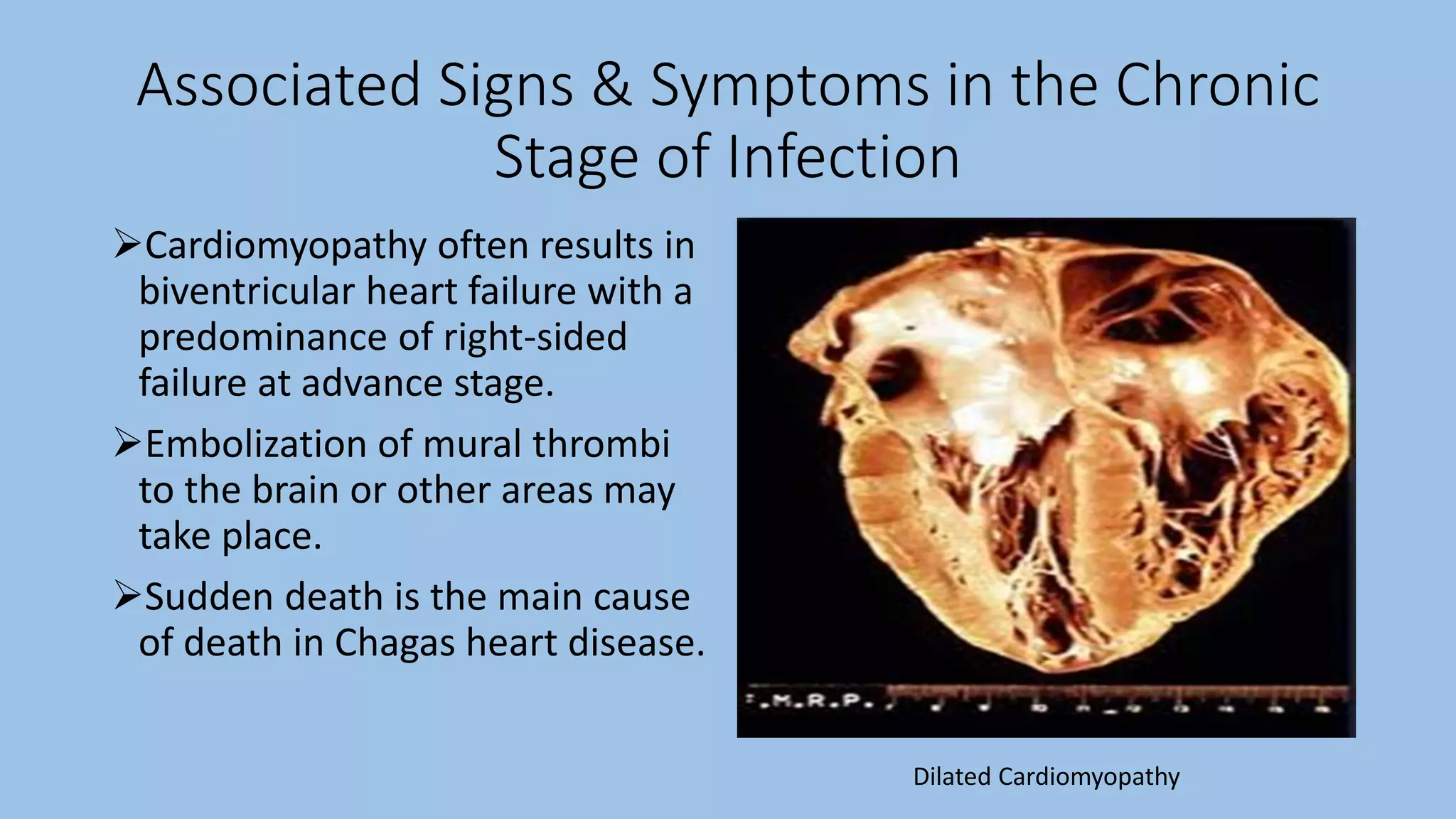 Chagas Disease (American Trypanosomiasis) | PPTX
