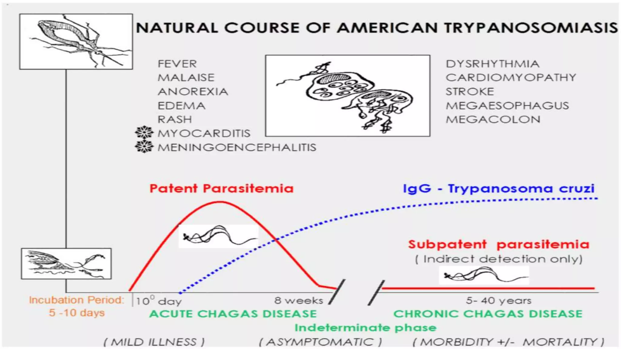 Chagas Disease (American Trypanosomiasis) | PPTX