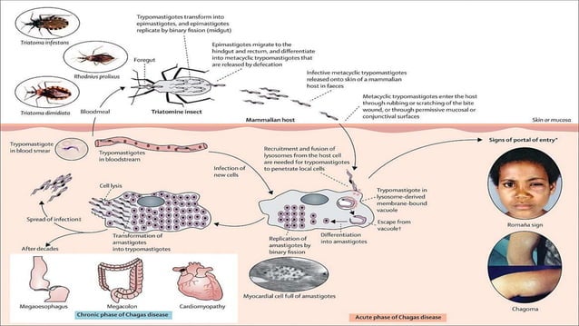 Chagas Disease (American Trypanosomiasis) | PPTX | Infectious Diseases ...