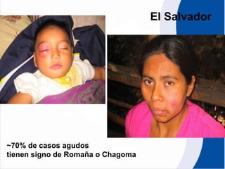 Chagas generalidades epidemiologia ciclo vital clinica dx tratamiento y ...