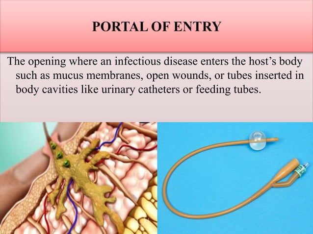 Chain of Infection | PPTX | Infectious Diseases | Diseases and Conditions