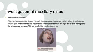 chair%20side%20investigation.pptx