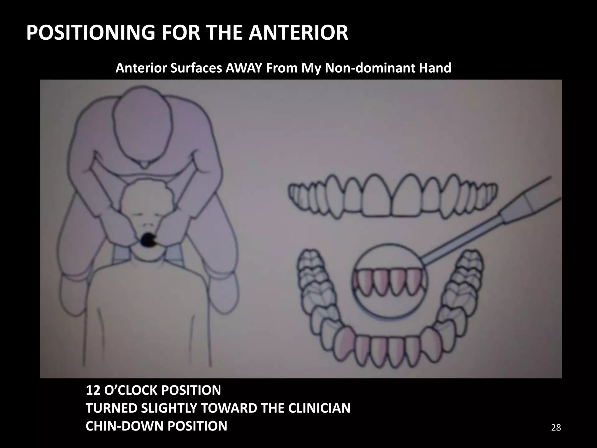 dental Chair position | PPTX