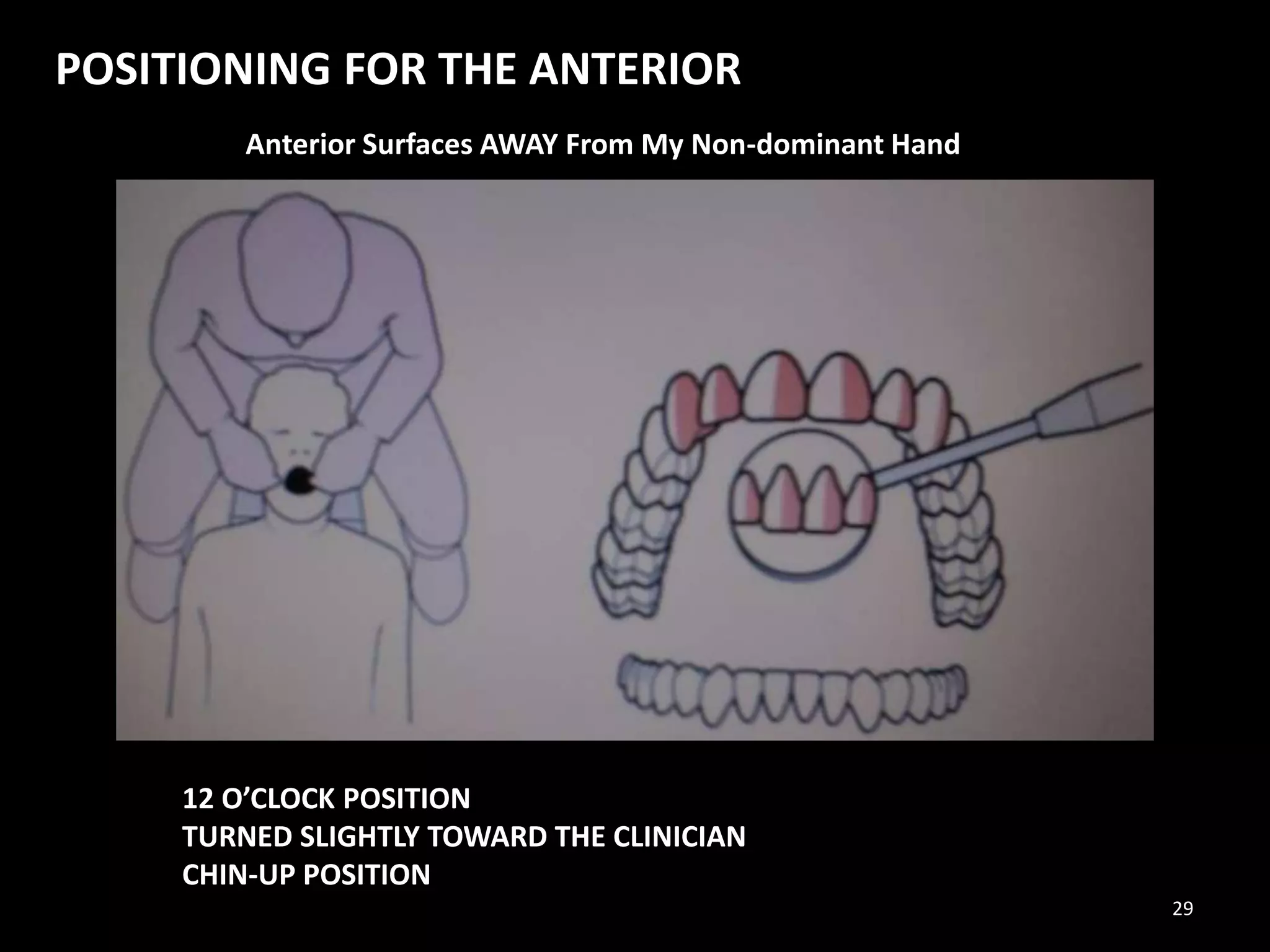 dental Chair position | PPTX