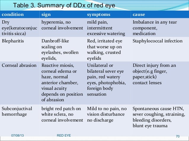 Chala kenenisa,ophtha seminarppt.