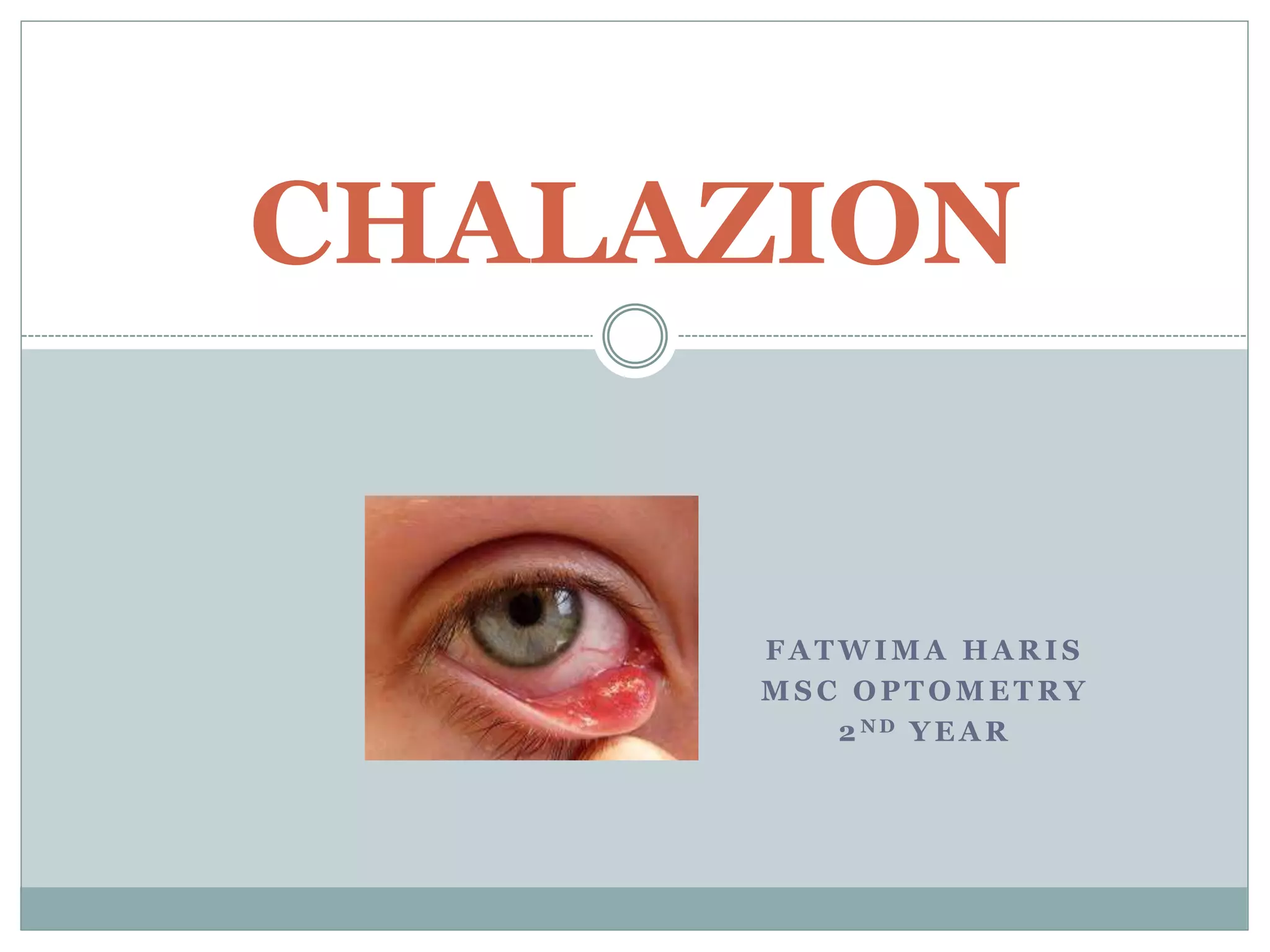 Chalazion | PPTX