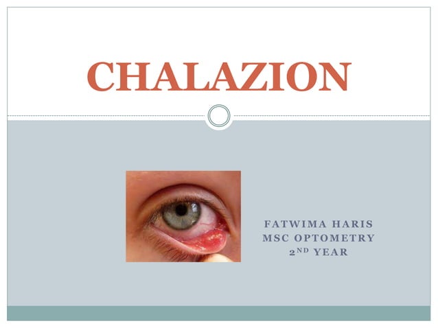 Chalazion | PPT