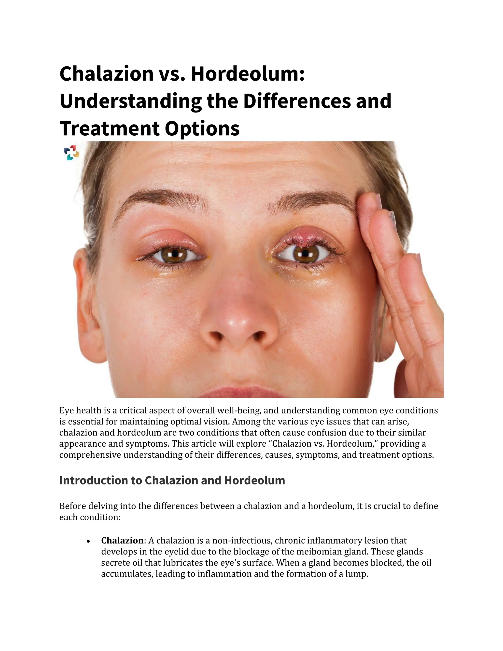 Chalazion Vs Hordeolum Differences Causes Symptoms And Treatment The Lifesciences