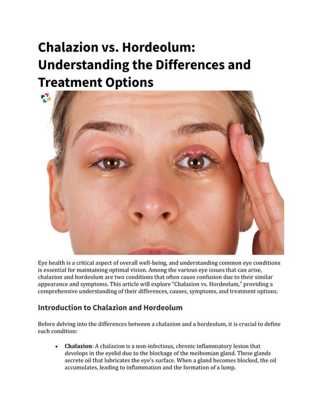 Chalazion vs. Hordeolum: Differences, Causes, Symptoms, and Treatment ...
