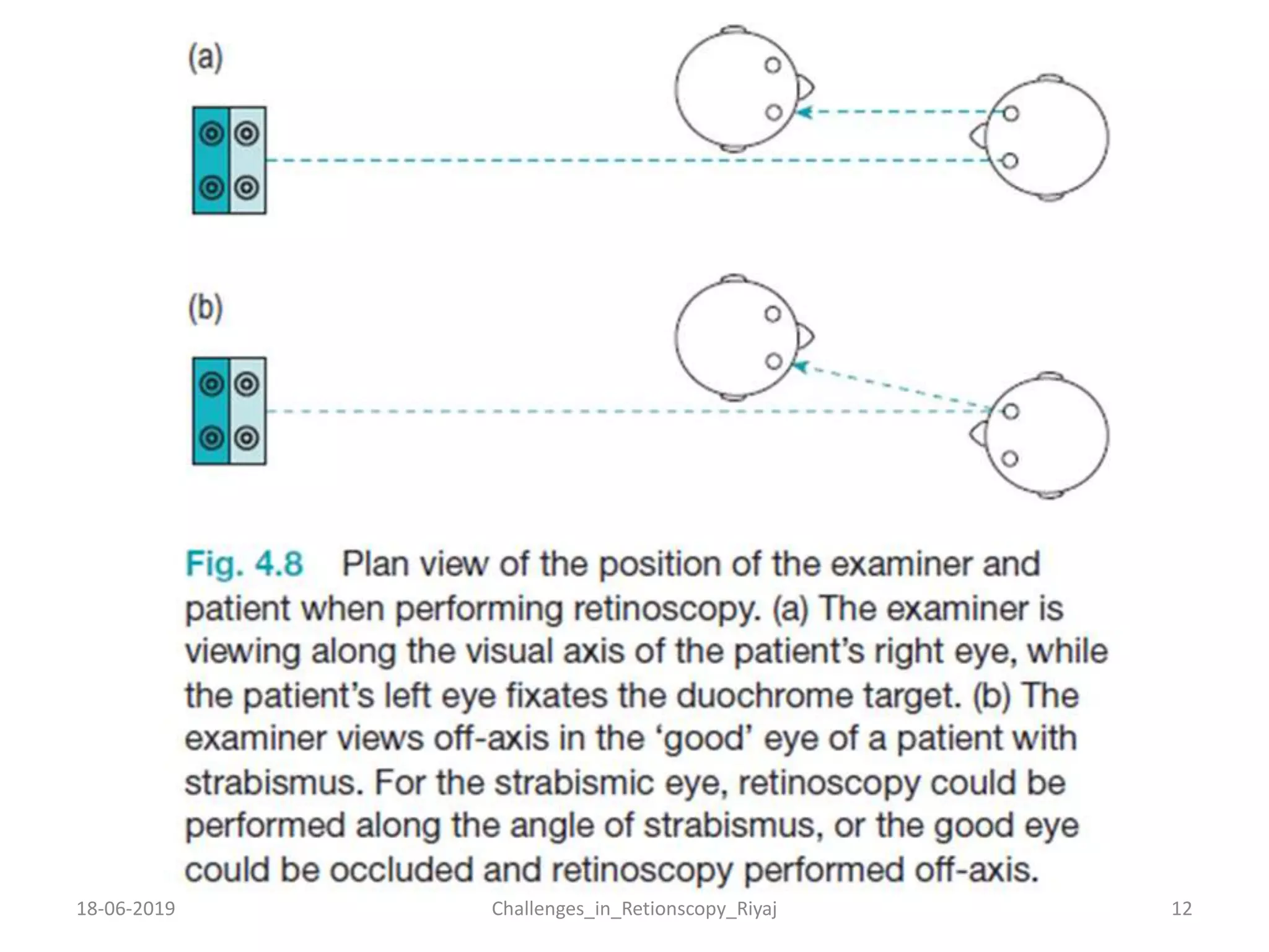Challenges in Refraction | PPTX