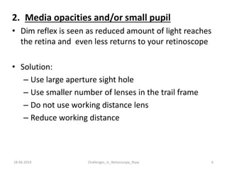 Challenges in Refraction | PPTX