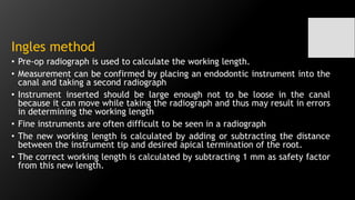 Challenges in working length determination | PPTX
