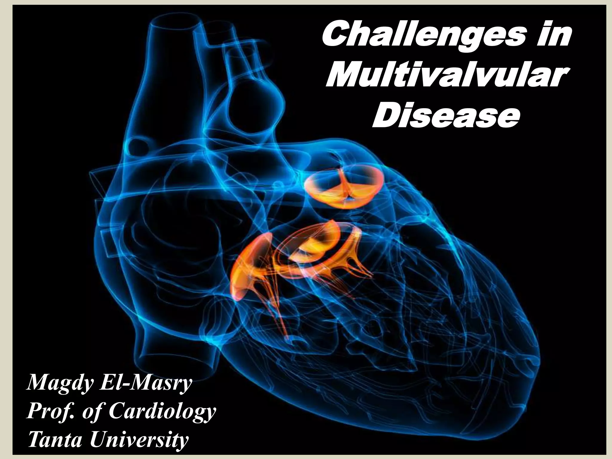 Challenges in Multivalvular Disease. | PPTX