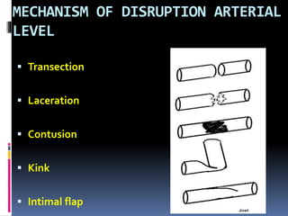 Challenges with vascular injuries in resource poor setting | PPT