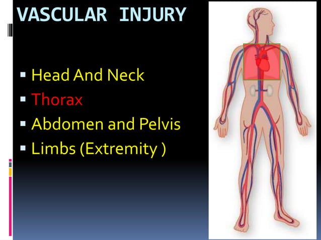 Challenges with vascular injuries in resource poor setting | PPT