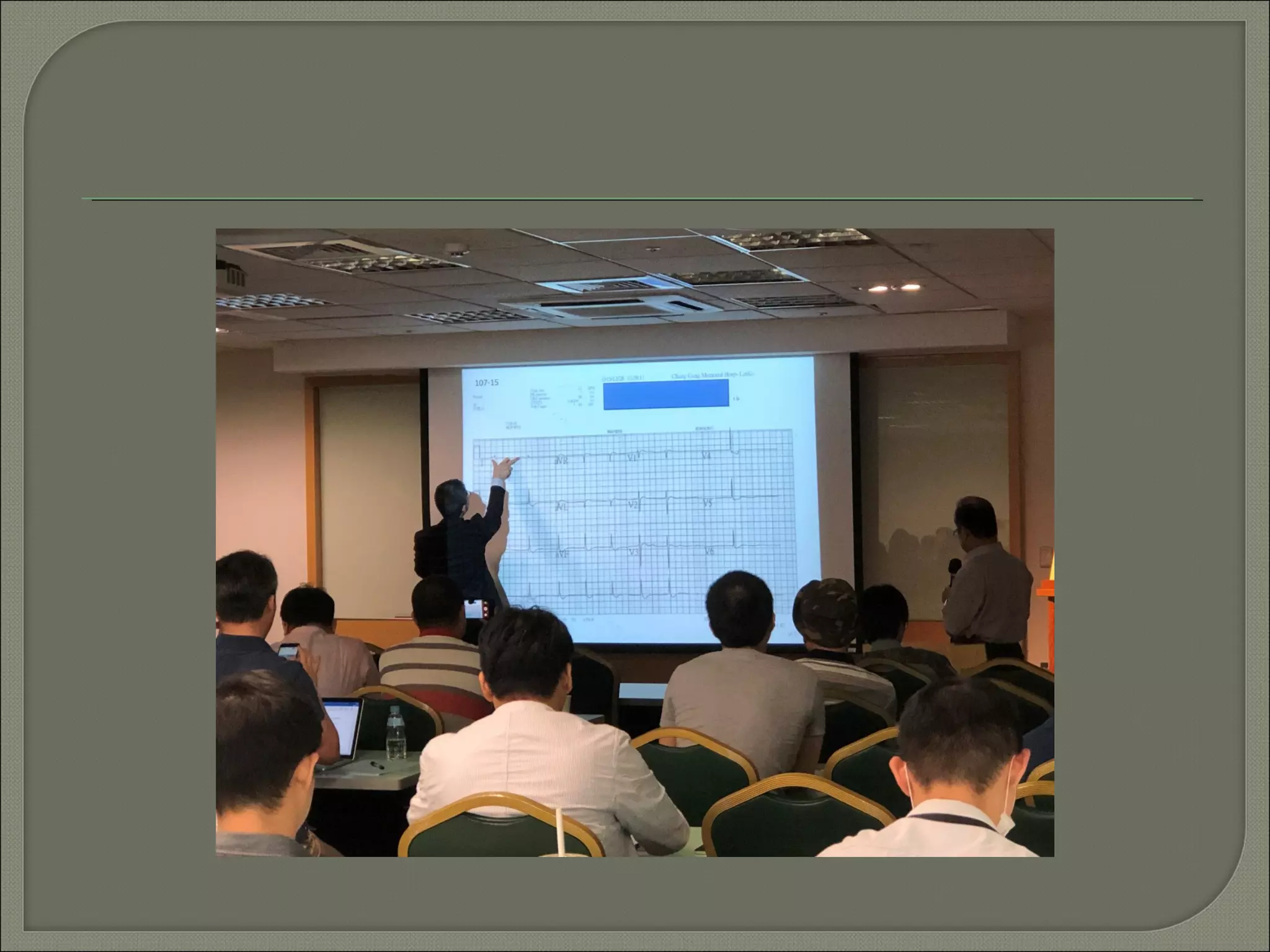 Challenging and Unknown ECGs | PPT