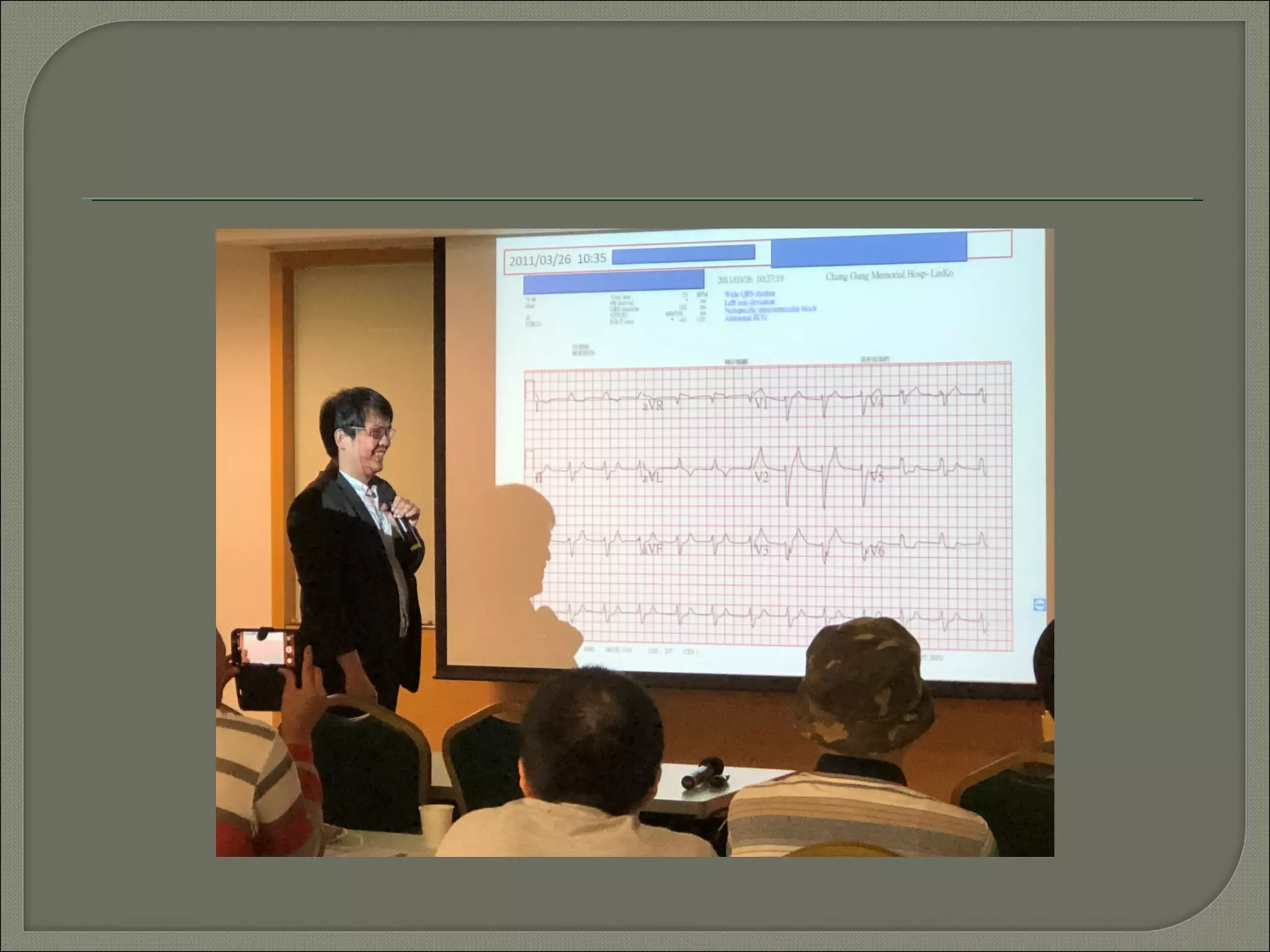 Challenging and Unknown ECGs | PPT