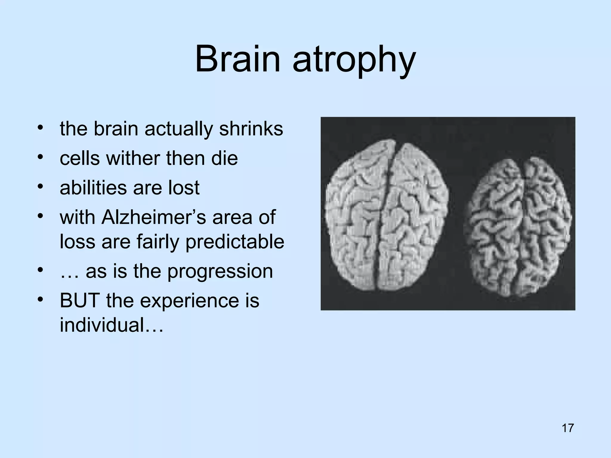 Teepa Snow, Dementia Expert, on Challenging Behaviors | PPT