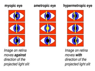 Challenging Refraction | PPT