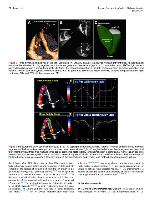 Chamber Quantification 2015 | PDF | Heart and Cardiovascular Diseases ...