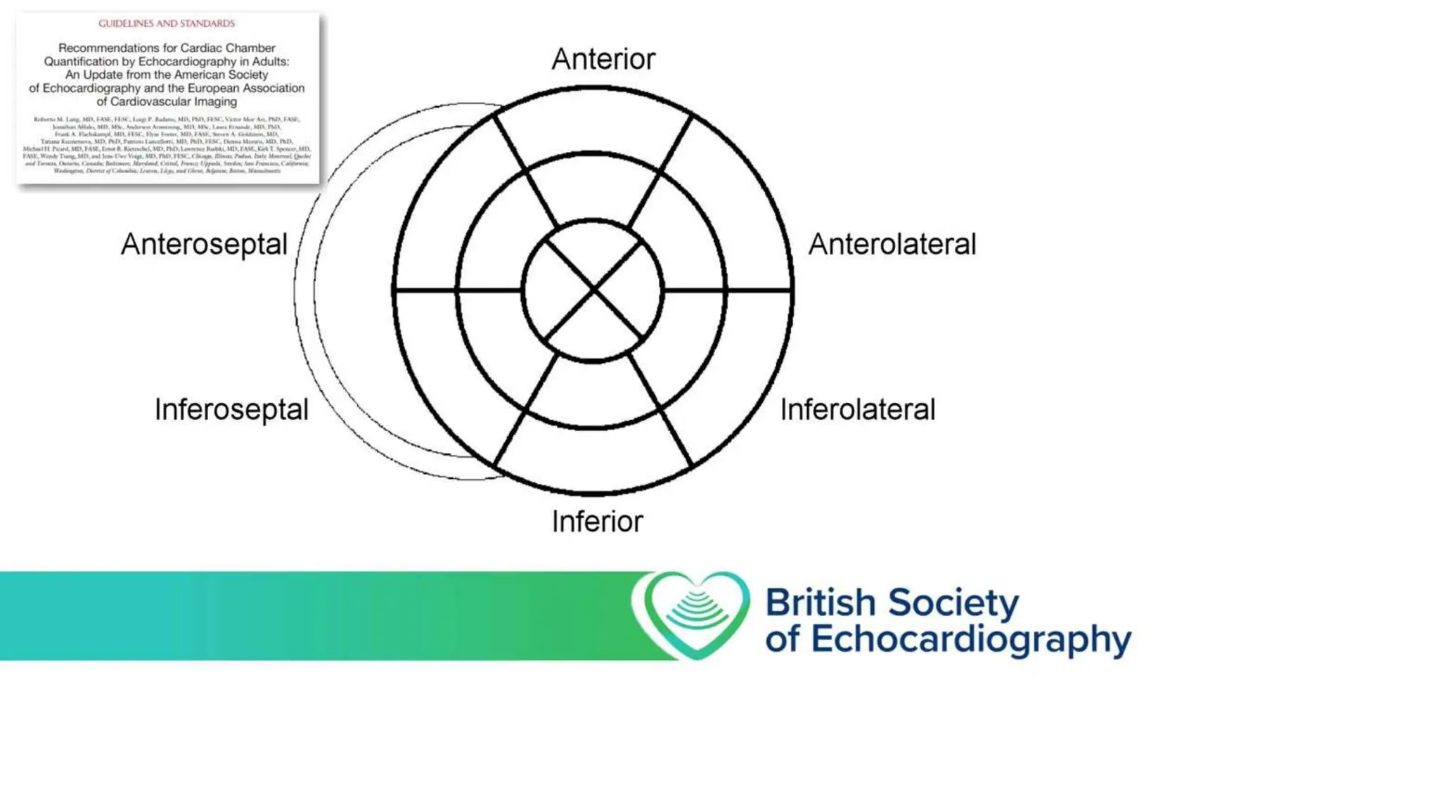 Chamber quantification by echo for ER and IM.pptx