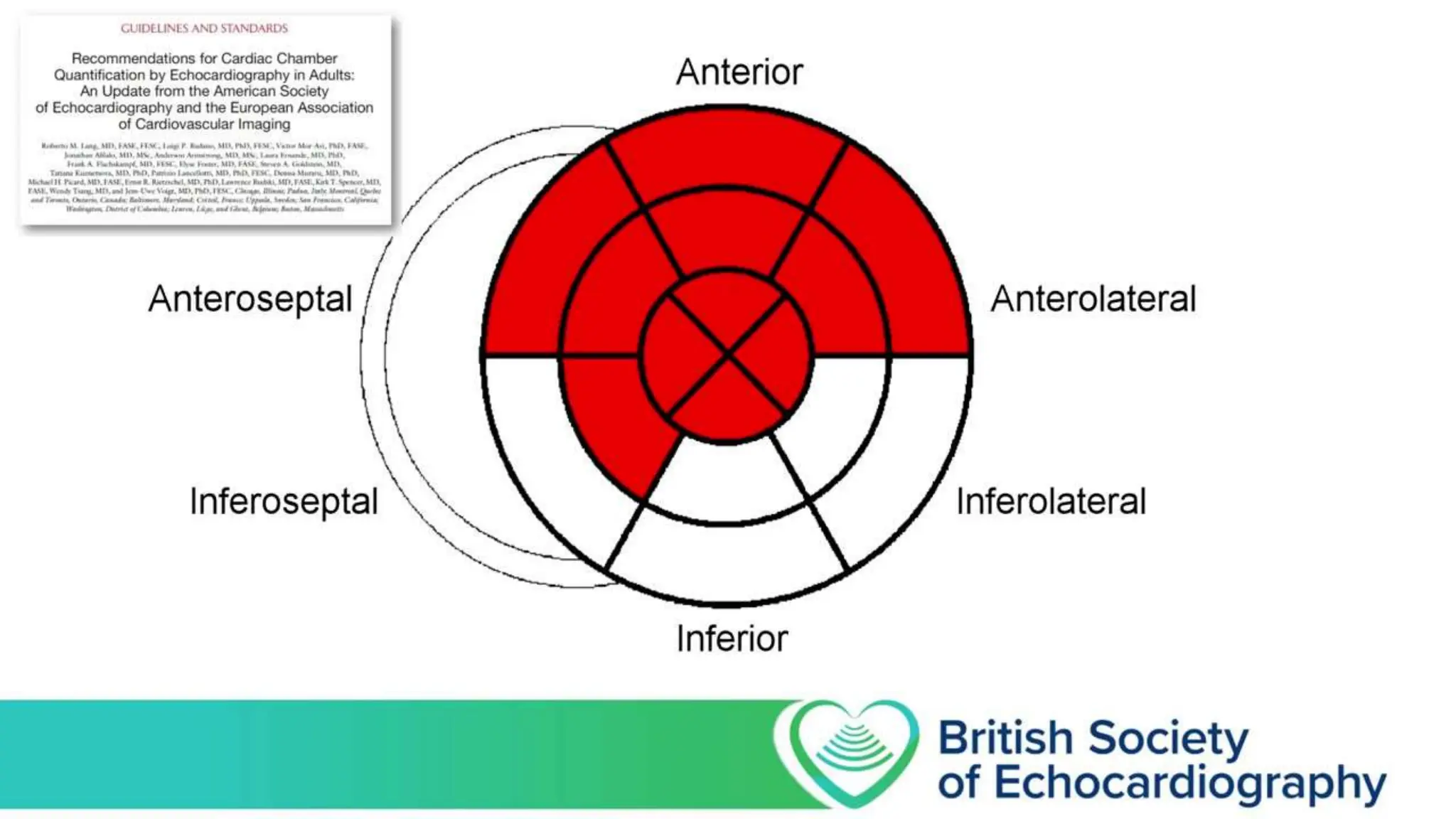 Chamber quantification by echo for ER and IM.pptx
