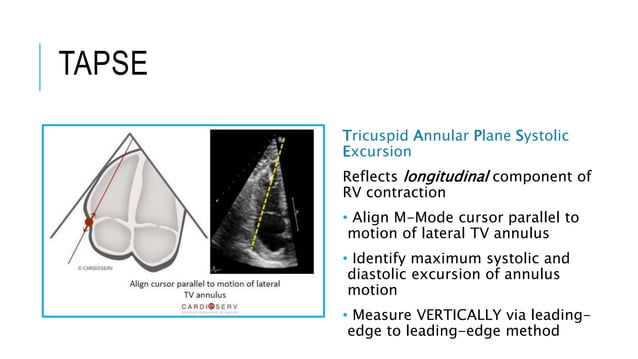 Chamber quantification by echo for ER and IM.pptx