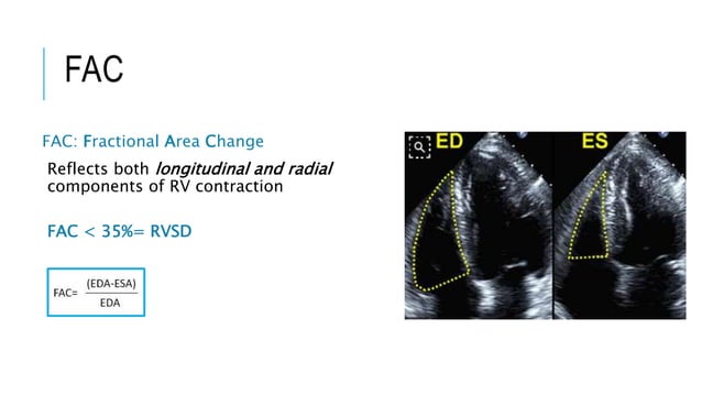 Chamber quantification by echo for ER and IM.pptx