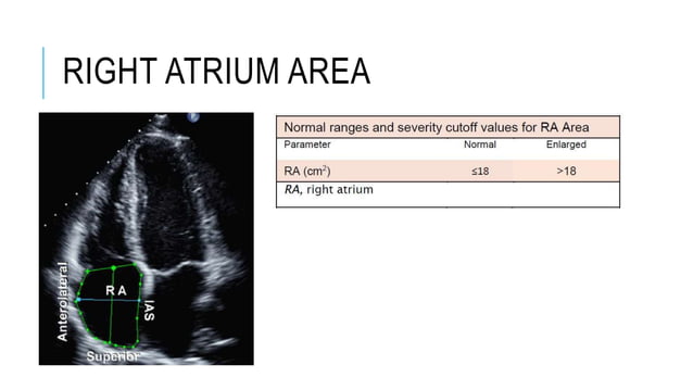 Chamber quantification by echo for ER and IM.pptx