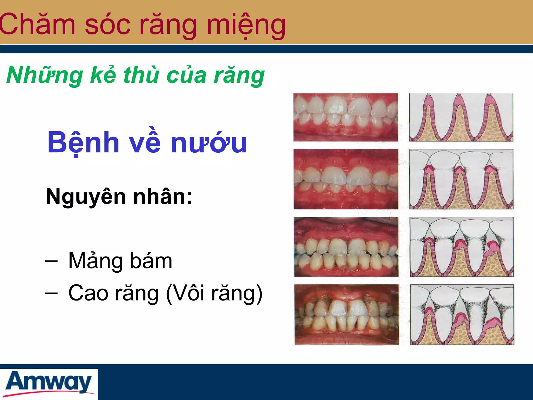 Cham soc rang mieng | PPT