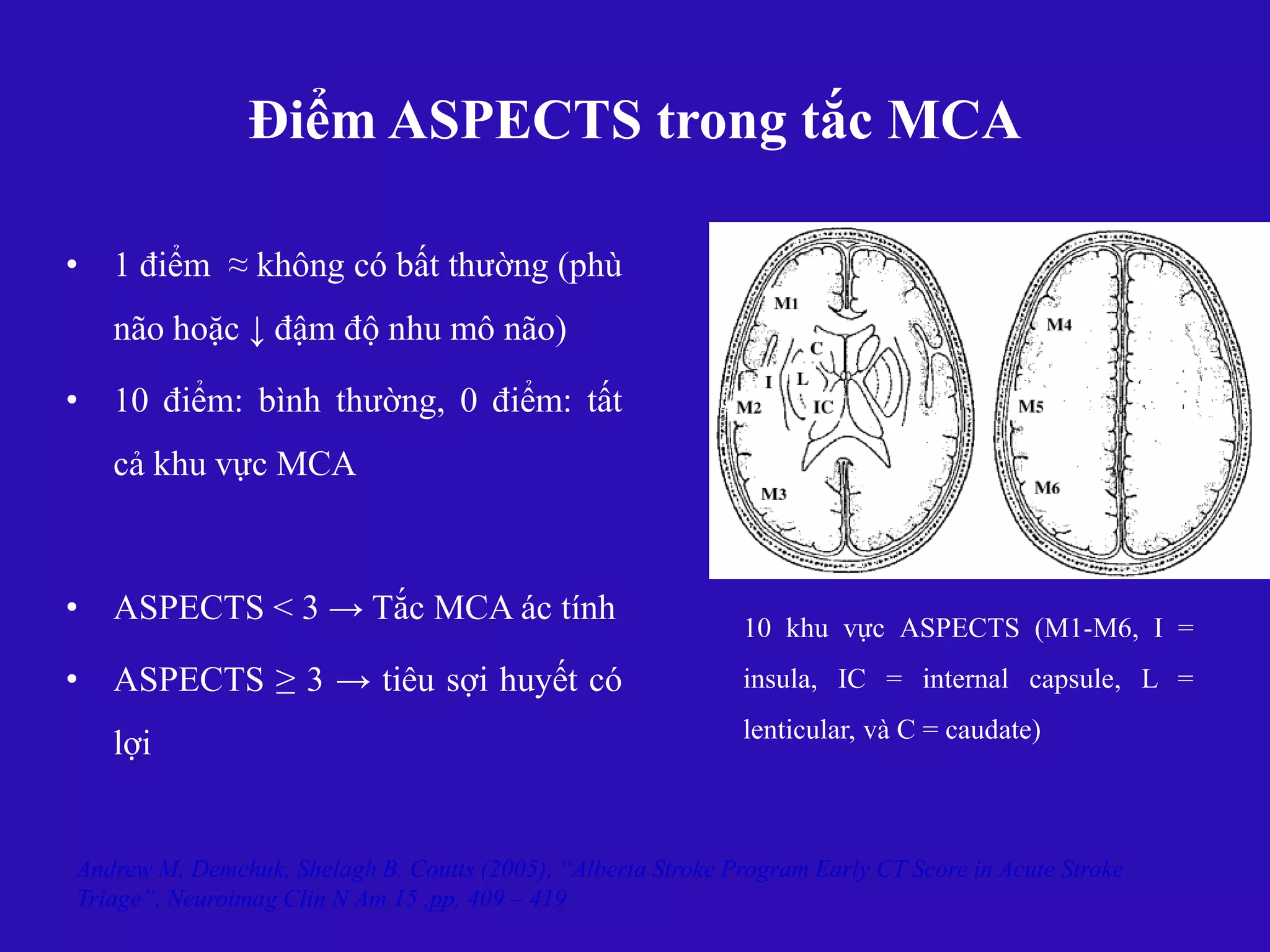 CHẨN ĐOÁN VÀ ĐIỀU TRỊ ĐỘT QUỴ NÃO | PDF