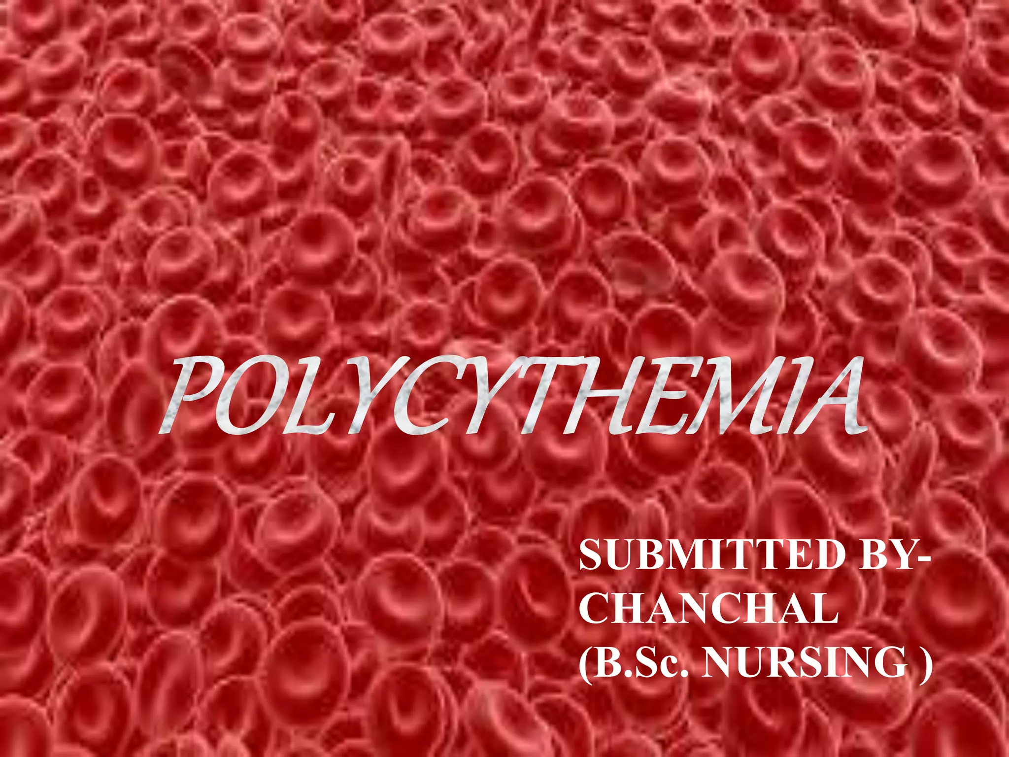 Polycythemia | PPTX
