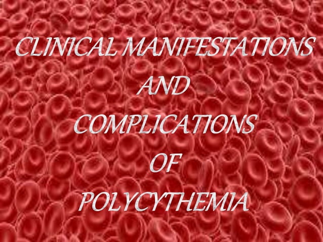 Polycythemia | PPTX