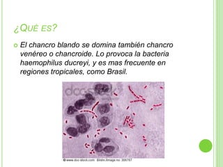 Chancro blando | PPTX