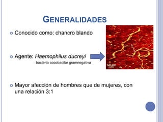 Chancroide, Chlamydia y Herpes | PPTX
