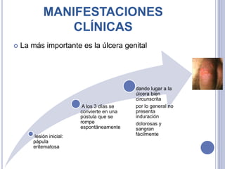 Chancroide, Chlamydia y Herpes | PPTX