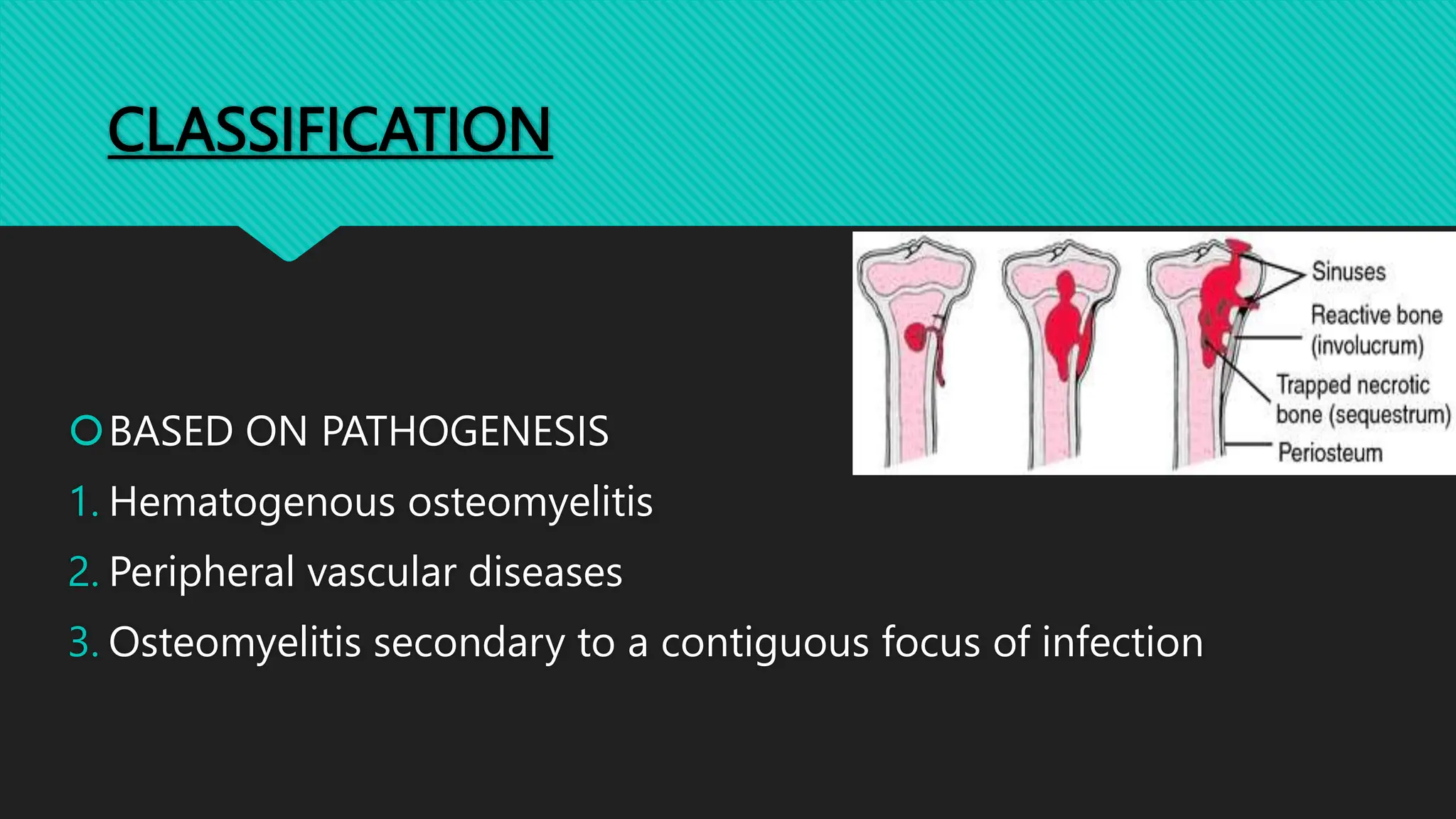 Chandana - Osteomyelitis .omfs surgery bds | PPTX