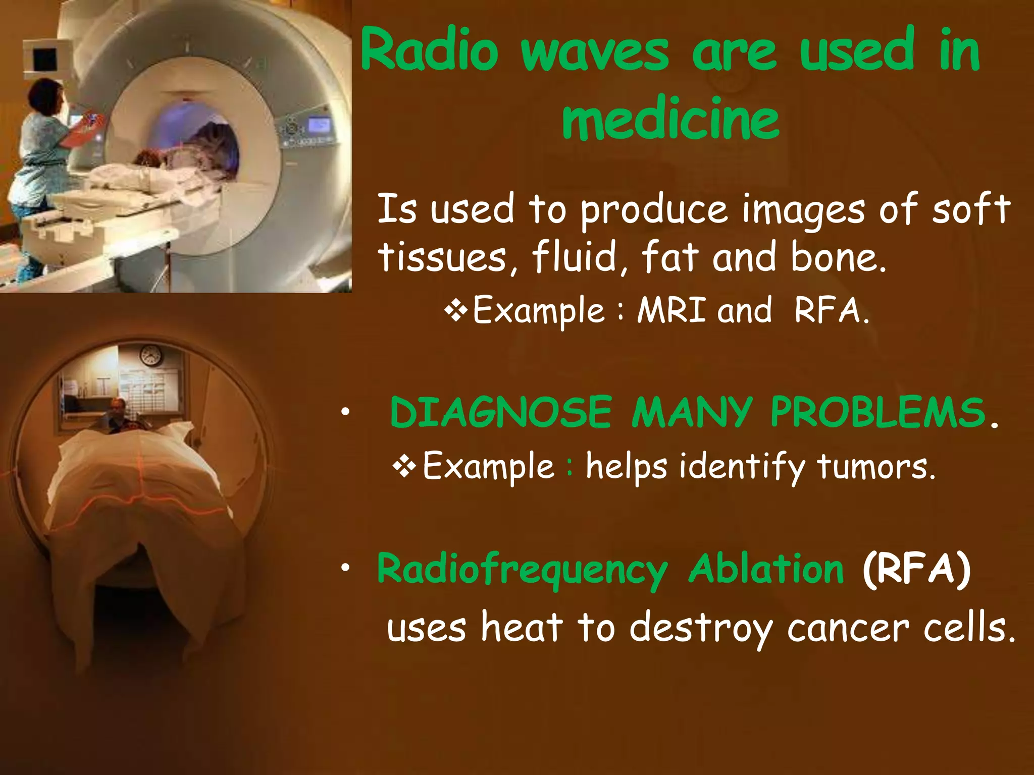 chandan radio.pptx