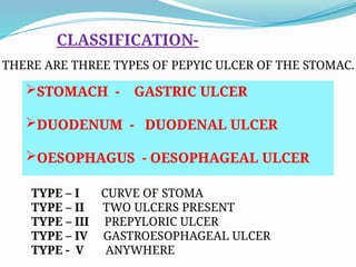 PEPTIC ULCER DISEASE The pud is serious condition.pptx