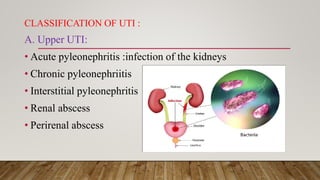Urinary tract infections-(UTI) pptx slide share | PPT