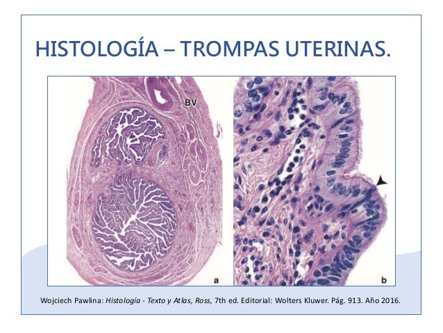 Histología De Trompas útero Y Ovarios
